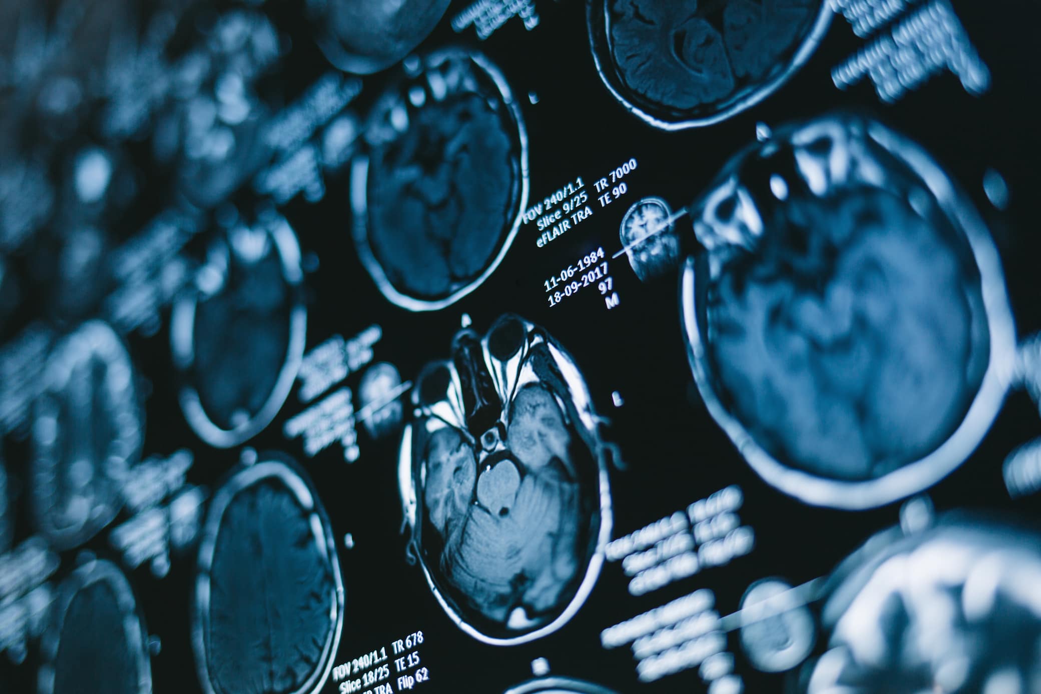 What is Teleradiology and How Can It Benefit Your Business?